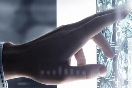 BIOVIA Pipeline Pilot Imaging Collection | Dassault Systèmes