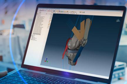 Abaqus Knee Simulator| SIMULIA - Dassault Systèmes